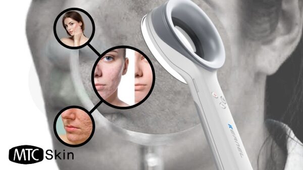 Cách nhận biết da qua máy soi da như thế nào, có chính xác?